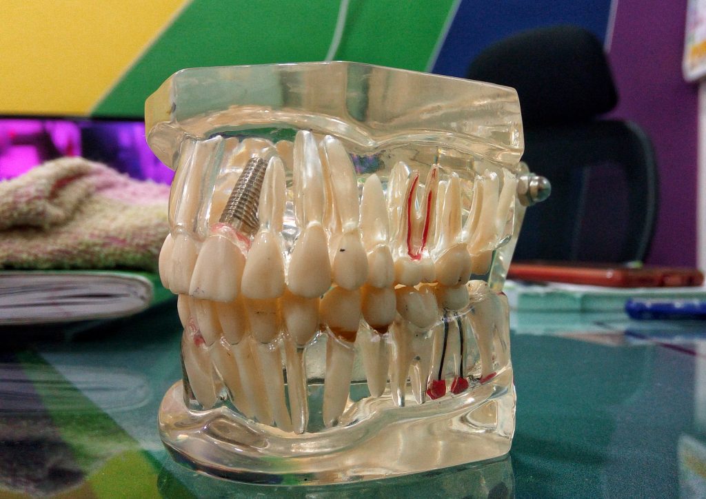 Dummy Jaw at a dental clinic - PixaHive
