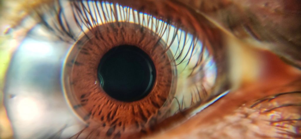 Human eye - PixaHive